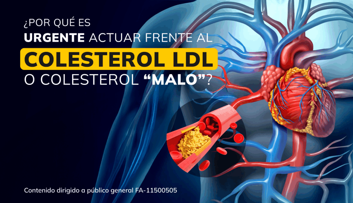 Webinar ¿Por qué es urgente actuar frente al colesterol LDL o colesterol “malo”? - Cambio ...